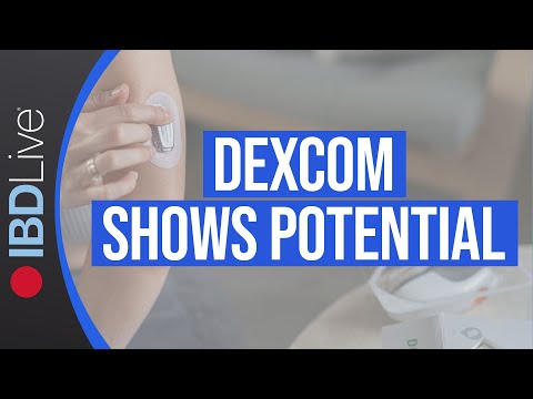 Dexcom Shows Potential On FDA Approval, But Can It Keep Climbing? | IBD ...